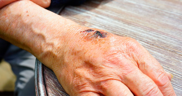 Manejo de Heridas - Insituto Ilumina | Hotmart