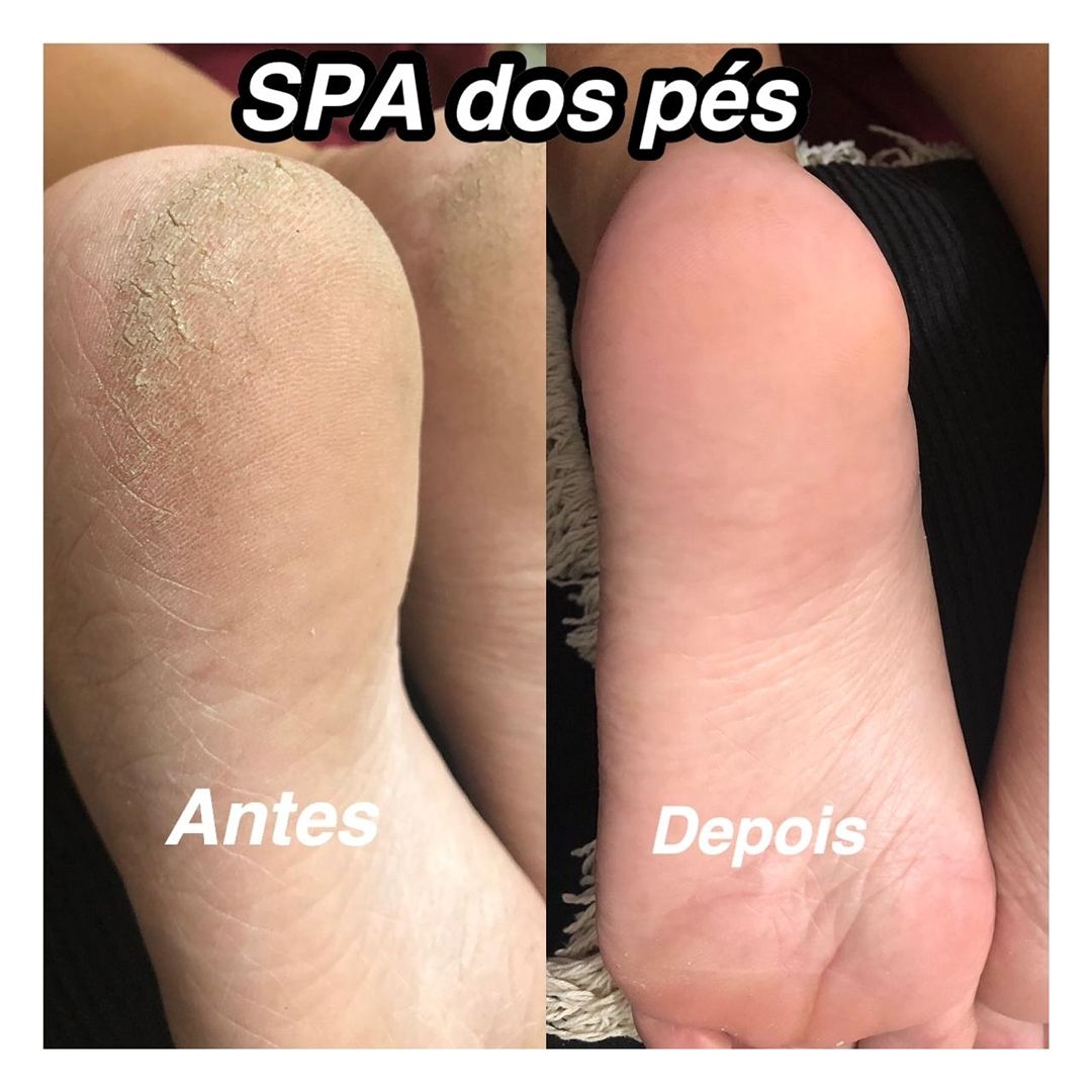 SPA DOS PÉS - Comercial Drumond | Hotmart