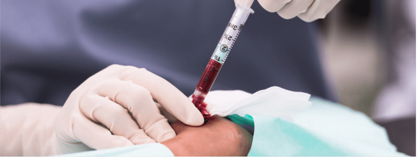 Curso Interpretação Prática da Gasometria Arterial - Rodrigo Corrêa ...