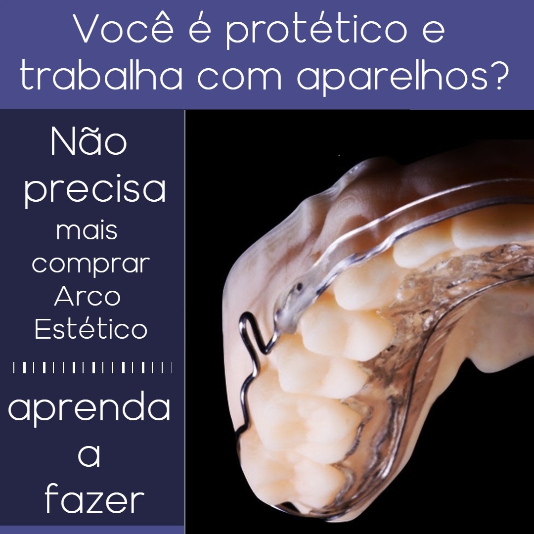 CONFECÇÃO DE ARCO ESTÉTICO PARA CONTENÇÃO DE HAWLEY - Viver de ...