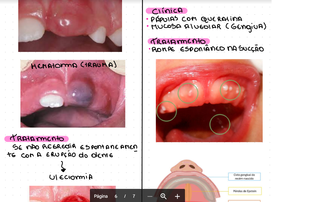 Cistos odontogênicos - Residência CTBMF - Pagel&Grisa | Hotmart