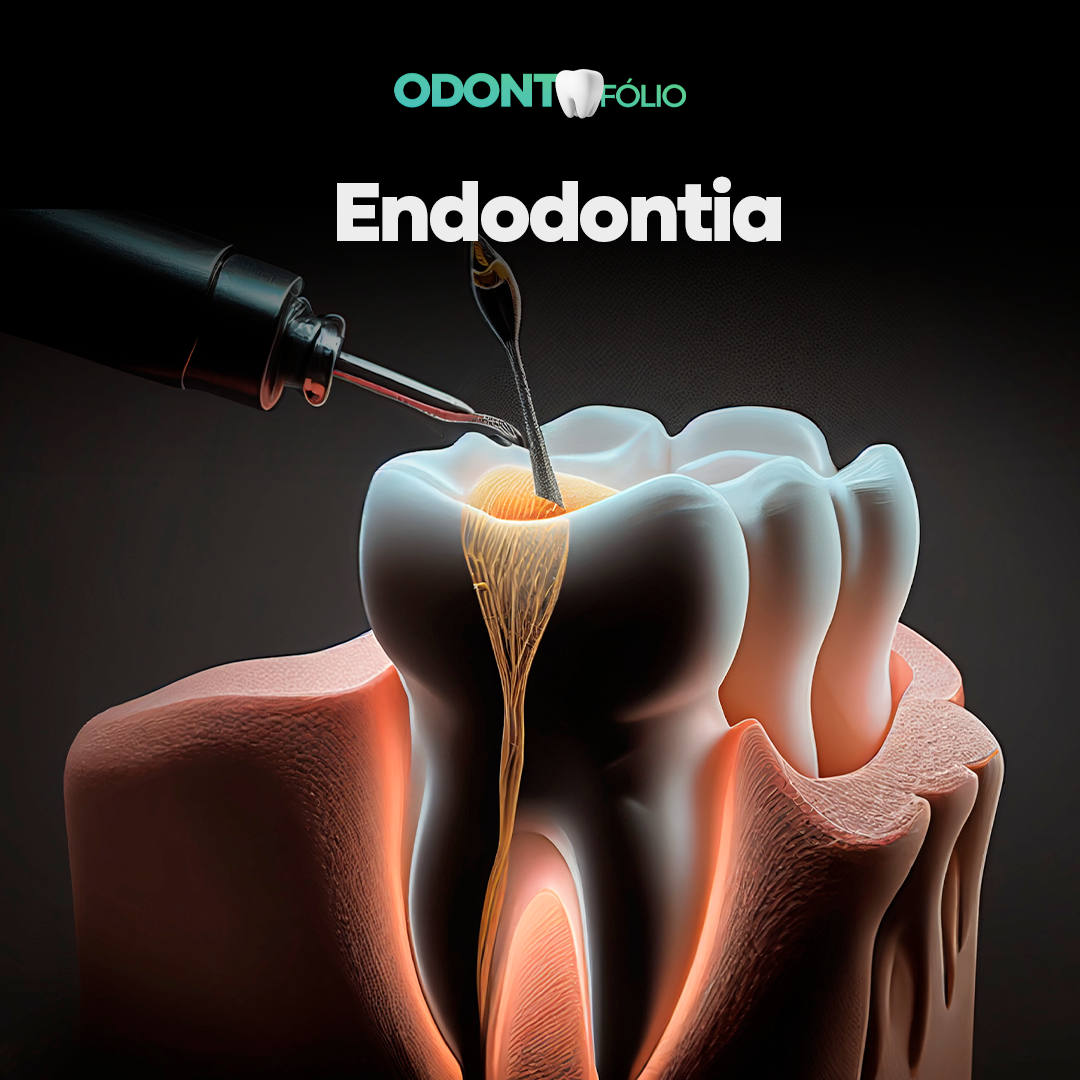 Portfólio de Endodontia Avançada - Aura Signa® | Hotmart