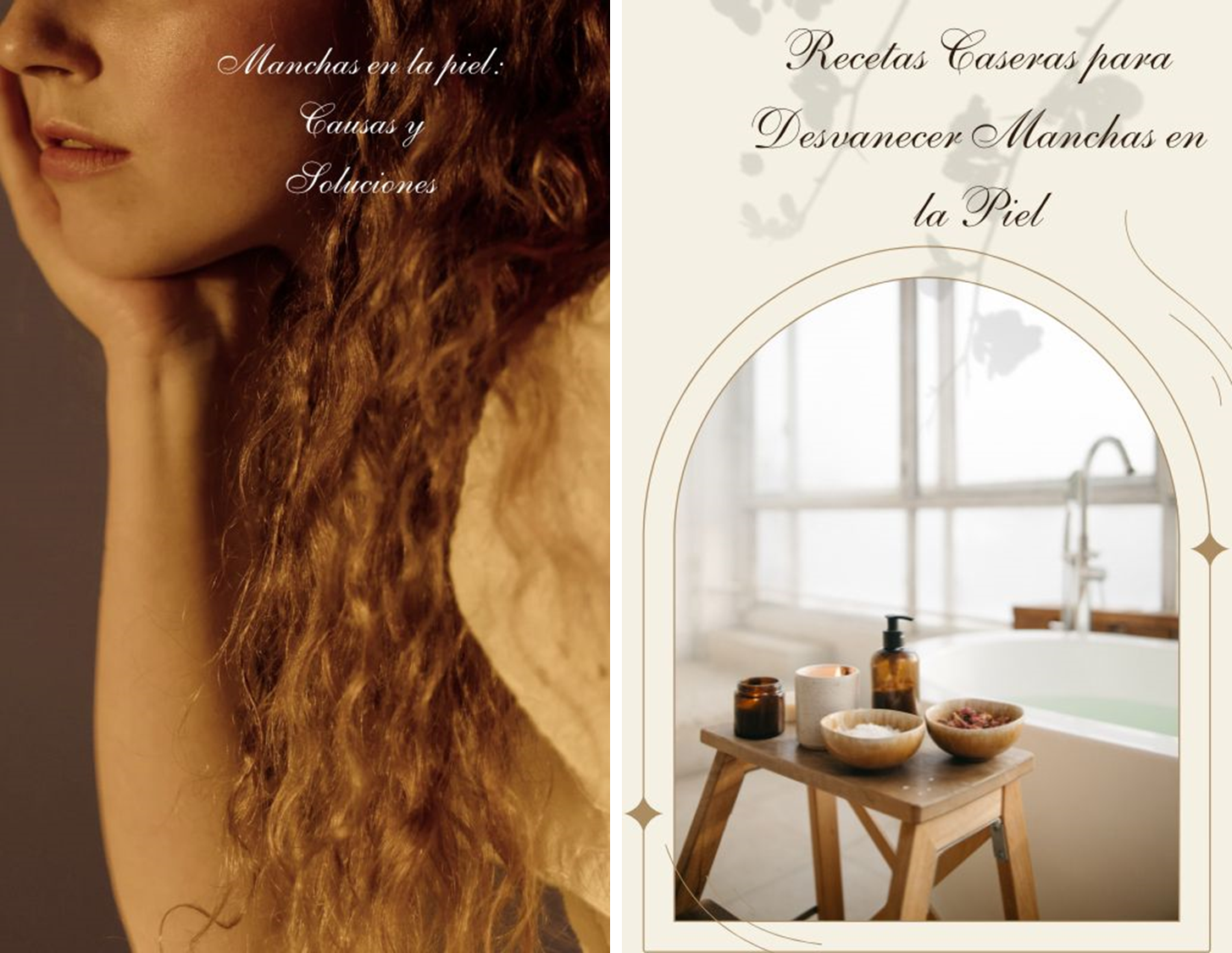 Manchas en la piel: Causas y Soluciones - Yudith García Ramírez | H...