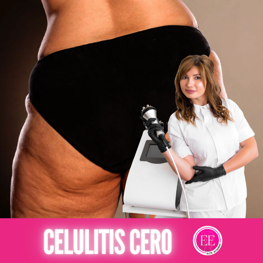 Celulitis Cero - Elite Expert Academy | Hotmart
