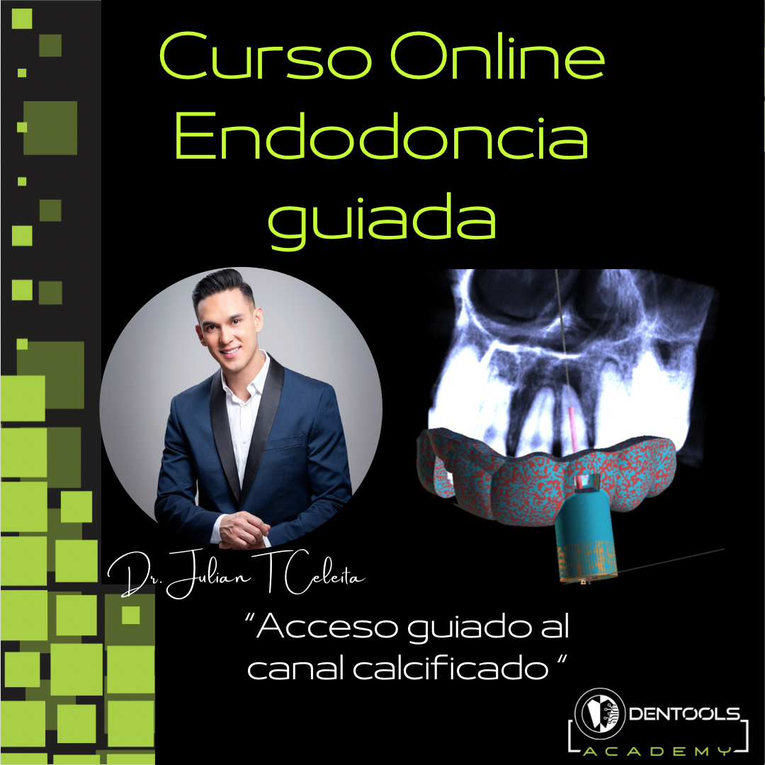 Curso Online Endodoncia guiada. Planificación digital para conducto...