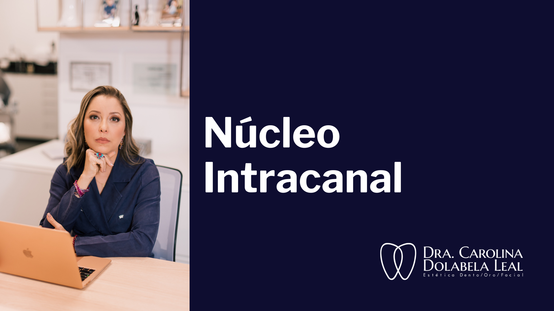 Treinamento I - Núcleo Intra Canal