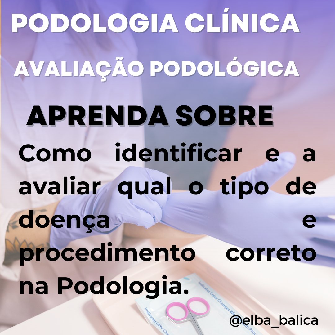 Avaliação Podologica - Maria Elba de Paula Balica | Hotmart