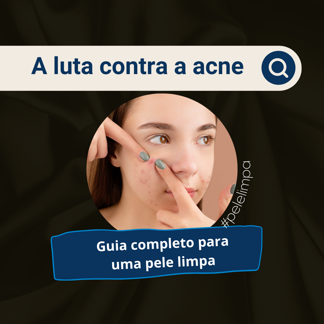 A luta contra a acne: Guia completo para uma pele limpa - Metodo de...
