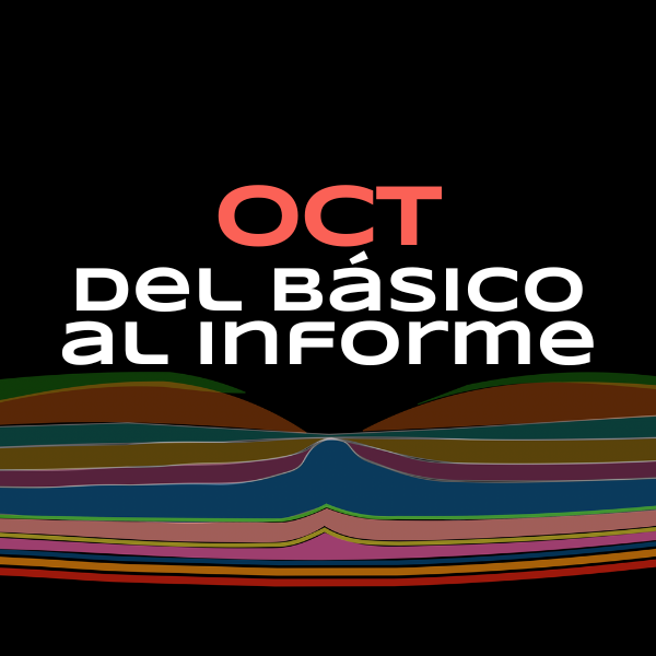 OCT desde lo básico hasta el informe - Orbit | Hotmart