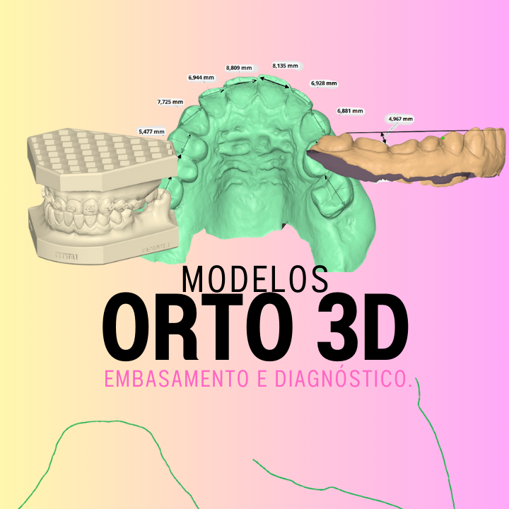 Modelos Orto 3D: Embasamento e Diagnóstico. - Thiago Pinheiro | Hot...