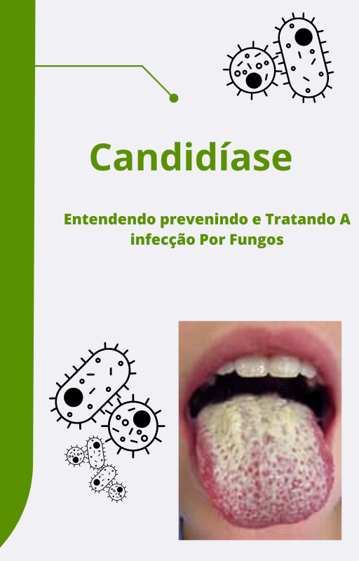 Candidíase Entendendo prevenindo e Tratando A infecção Por Fungos