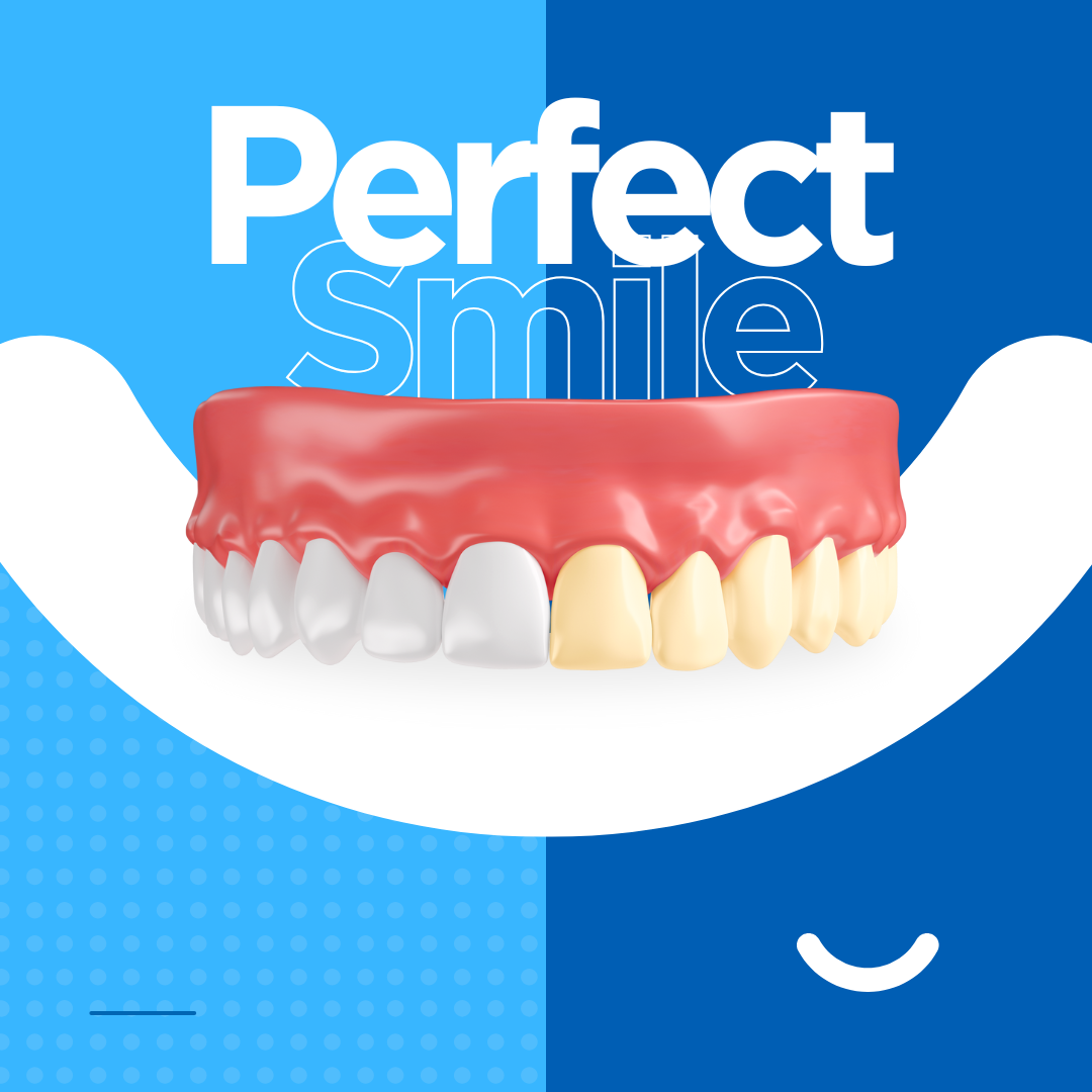 Perfect Smile - Discoveries | Hotmart