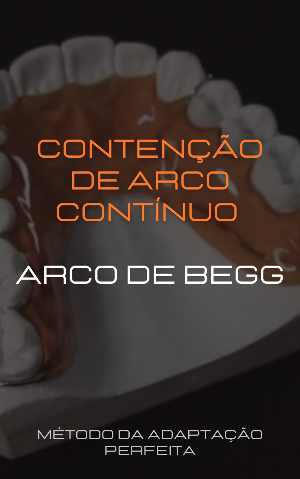 Contenção de arco contínuo (arco de Begg)
