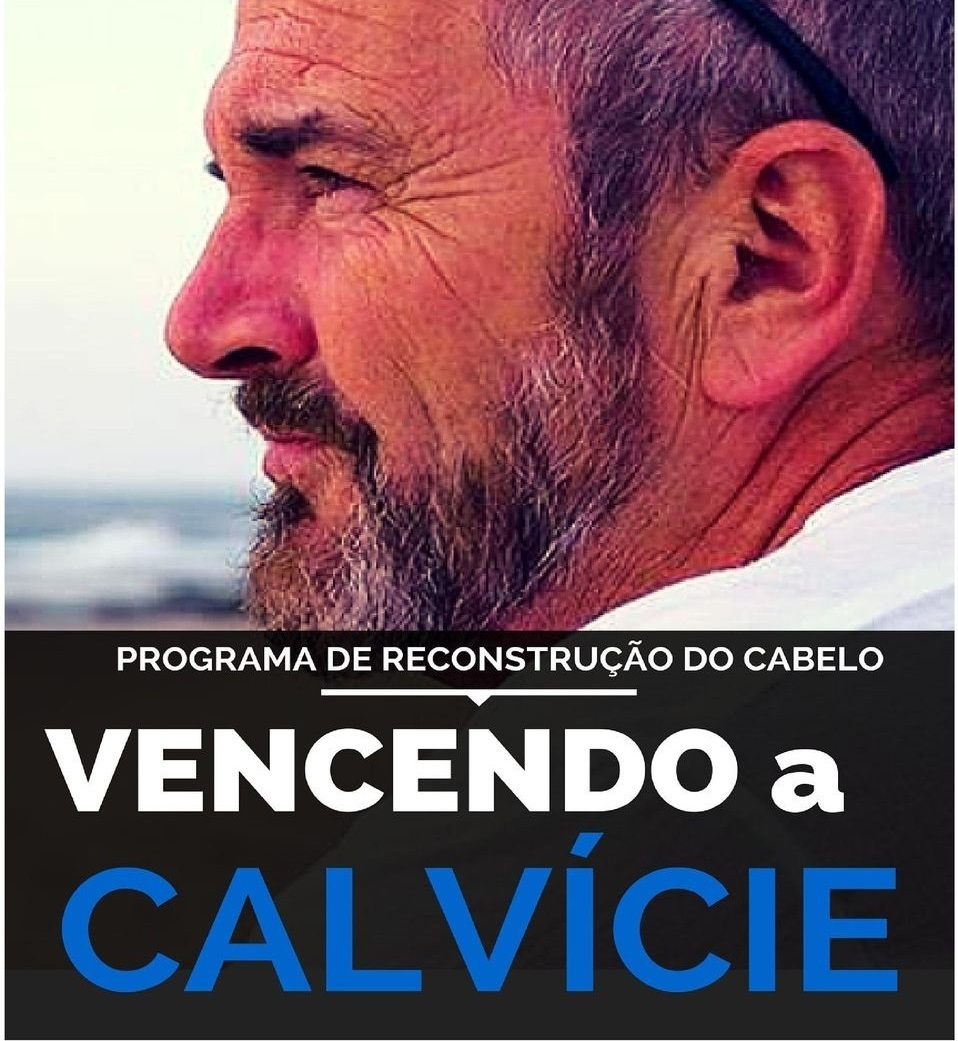 Vencendo a Calvície