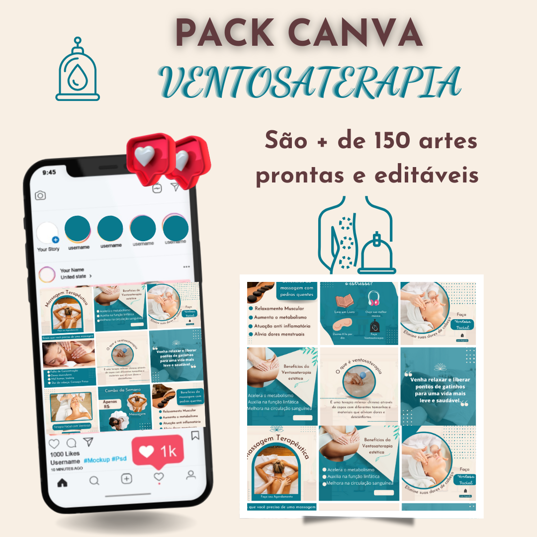 Pack Canva Ventosaterapia - Joyce alves | Hotmart