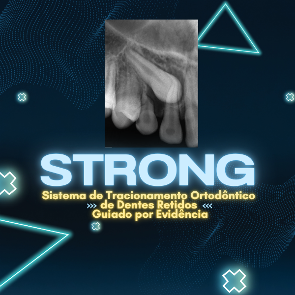 STRONG – Sistema de Tracionamento Ortodôntico de Dentes Retidos Gui...
