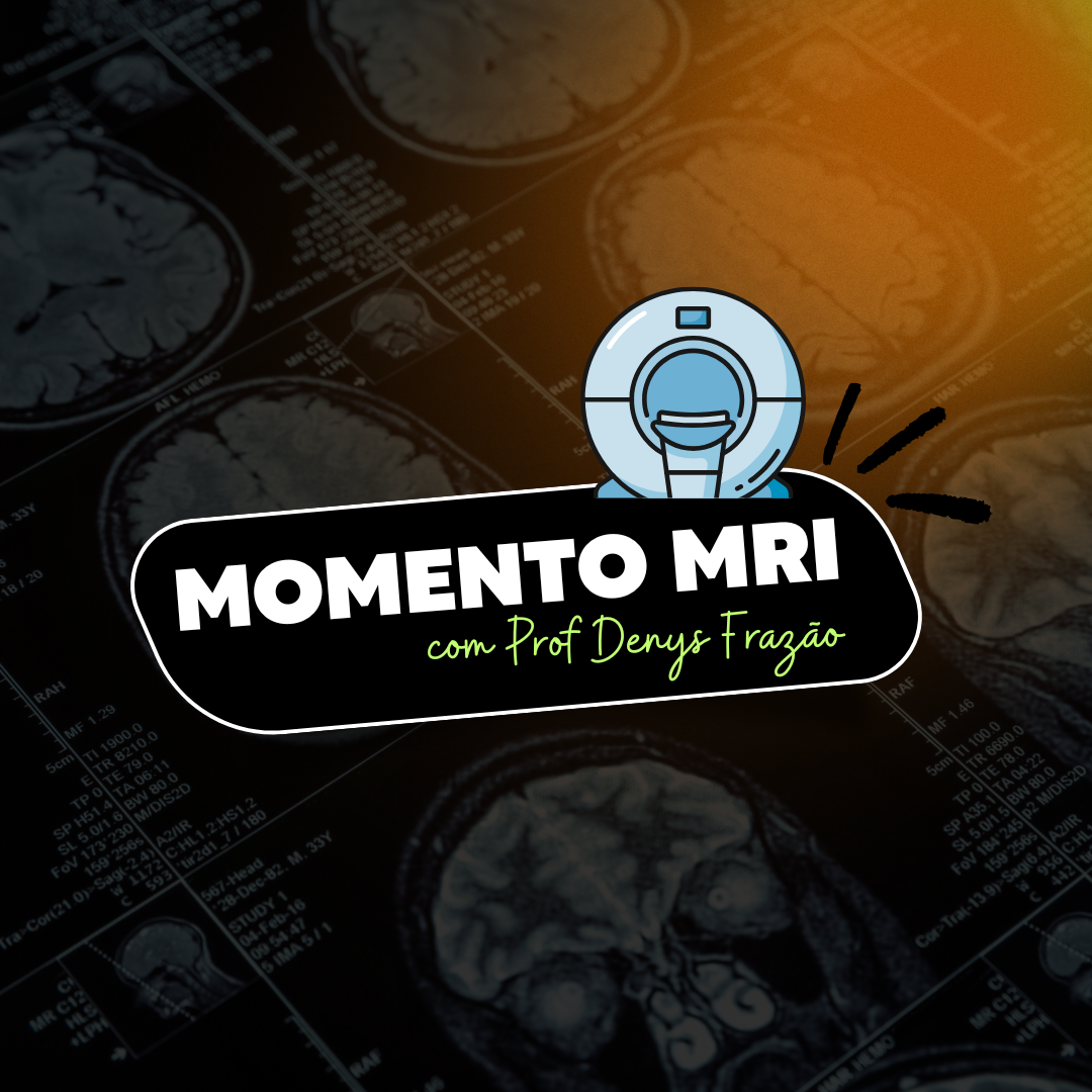 MOMENTO MRI com Prof. Denys Frazão