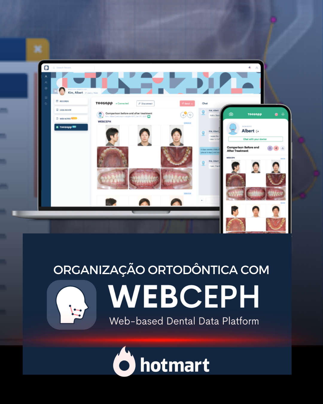 Webceph