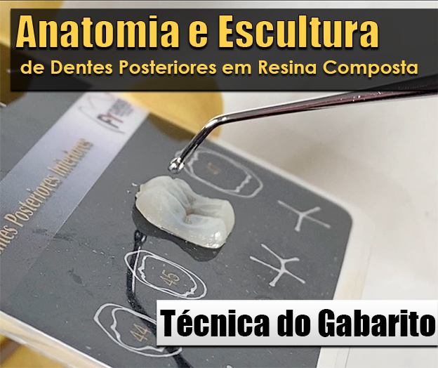 Técnica do Gabarito: Anatomia e Escultura de Dentes Posteriores em ...