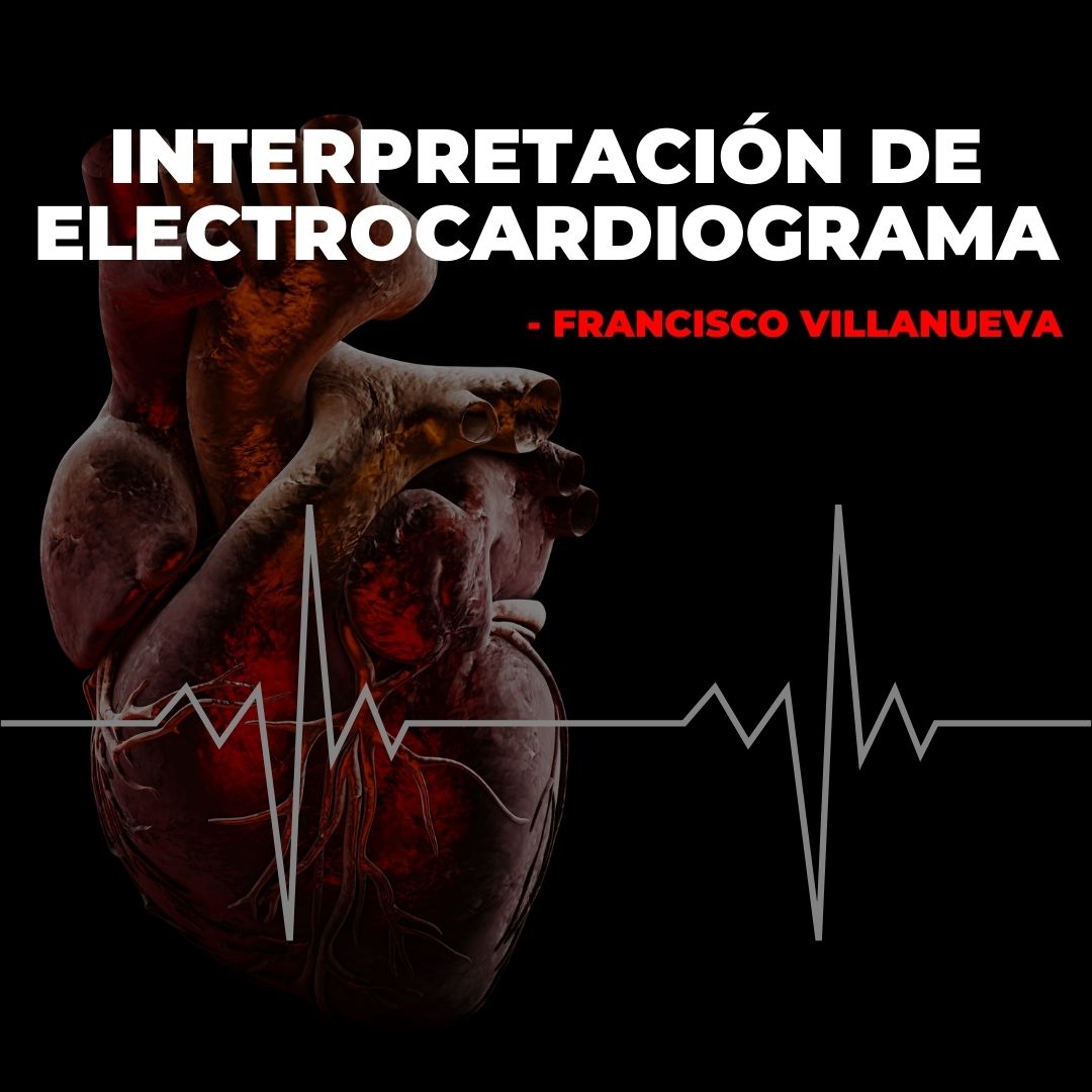 Interpretación de Electrocardiograma (EKG) - NURSE EDUCATION | Hotmart