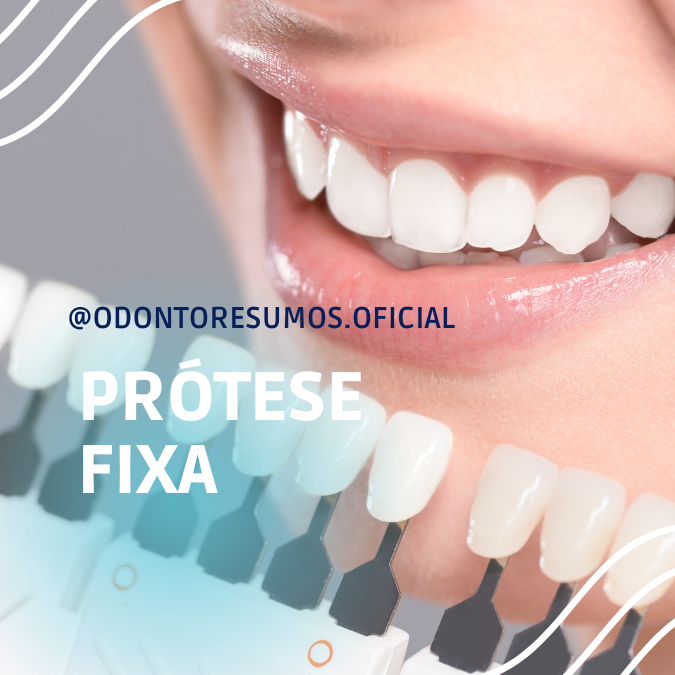Prótese Fixa - Resumo - Gabriel Elias do Nascimento | Hotmart