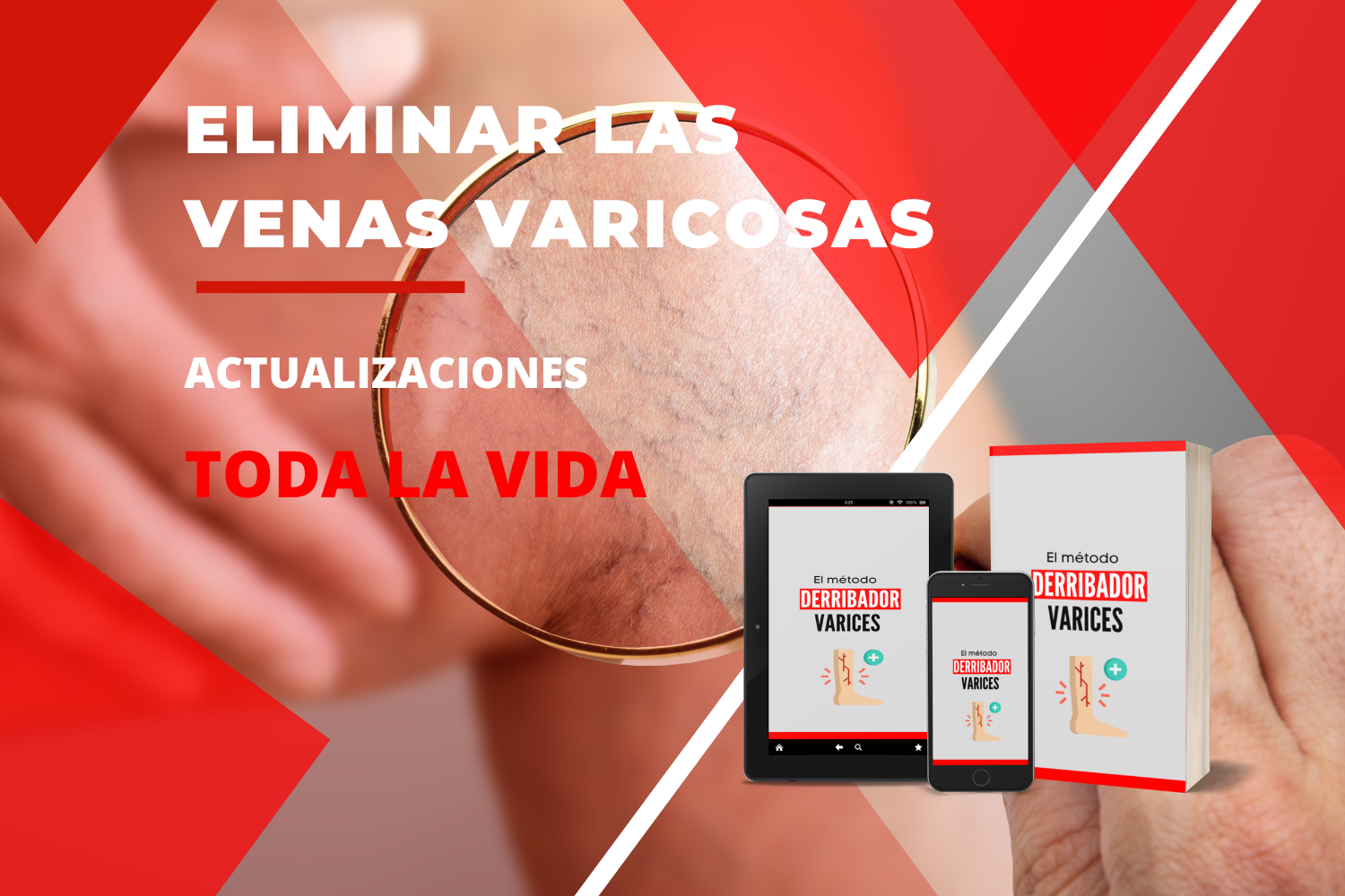 actualizaciones en protocolo eliminar varices - Samuel Luiz Buzzat...