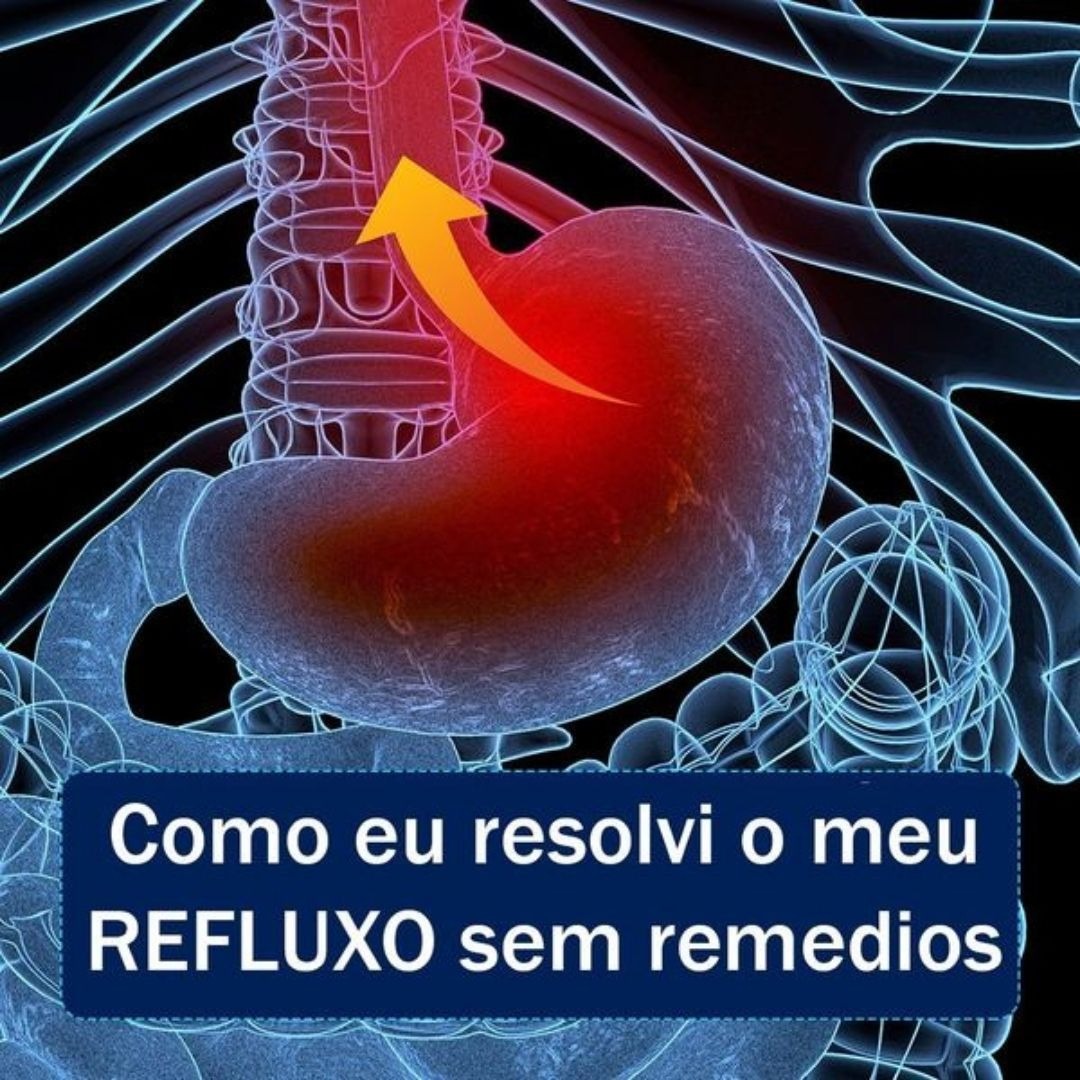 O Fim do Refluxo