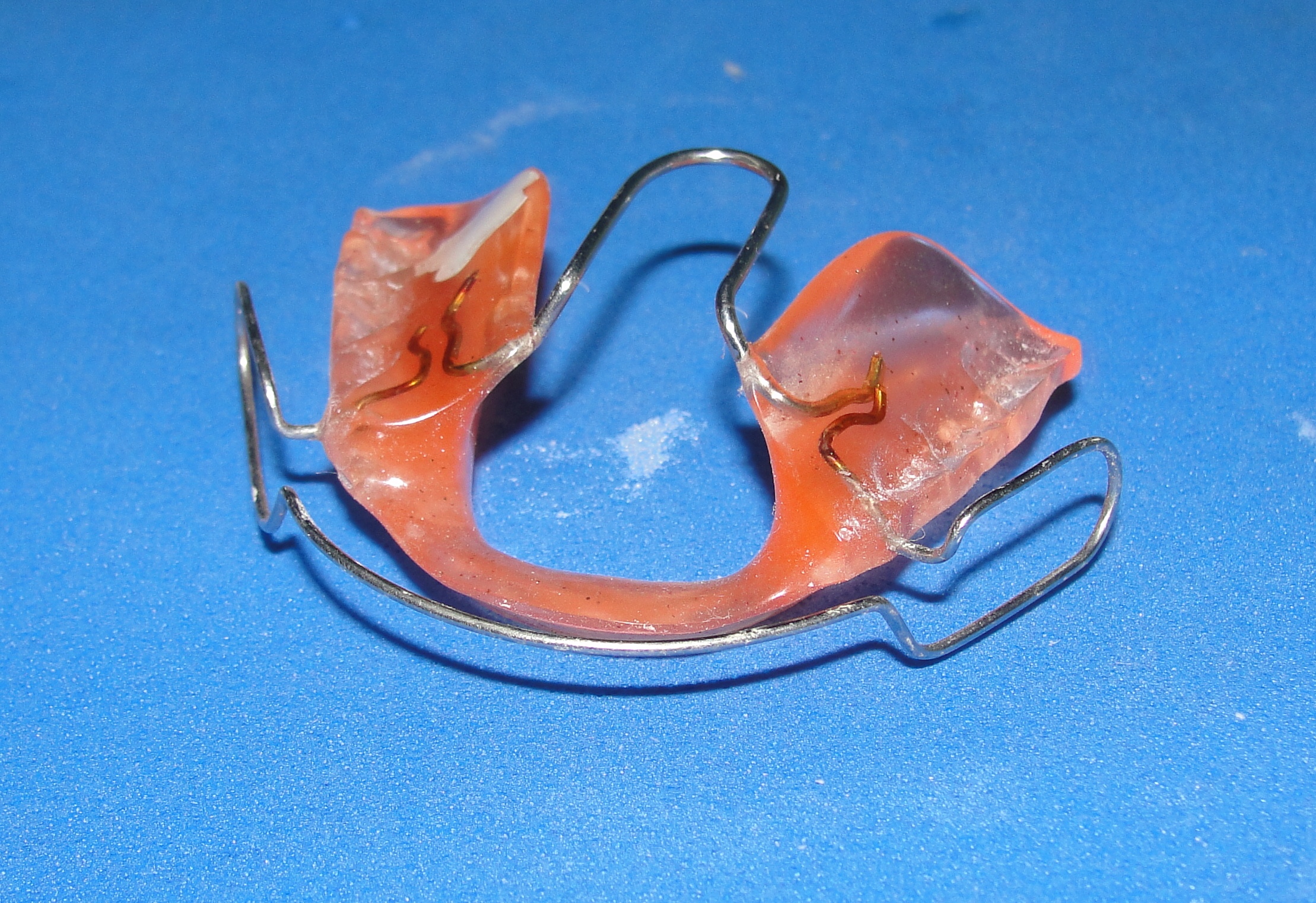 Aparelho Bionator de Balters - Técnica de Confecção Laboratorial