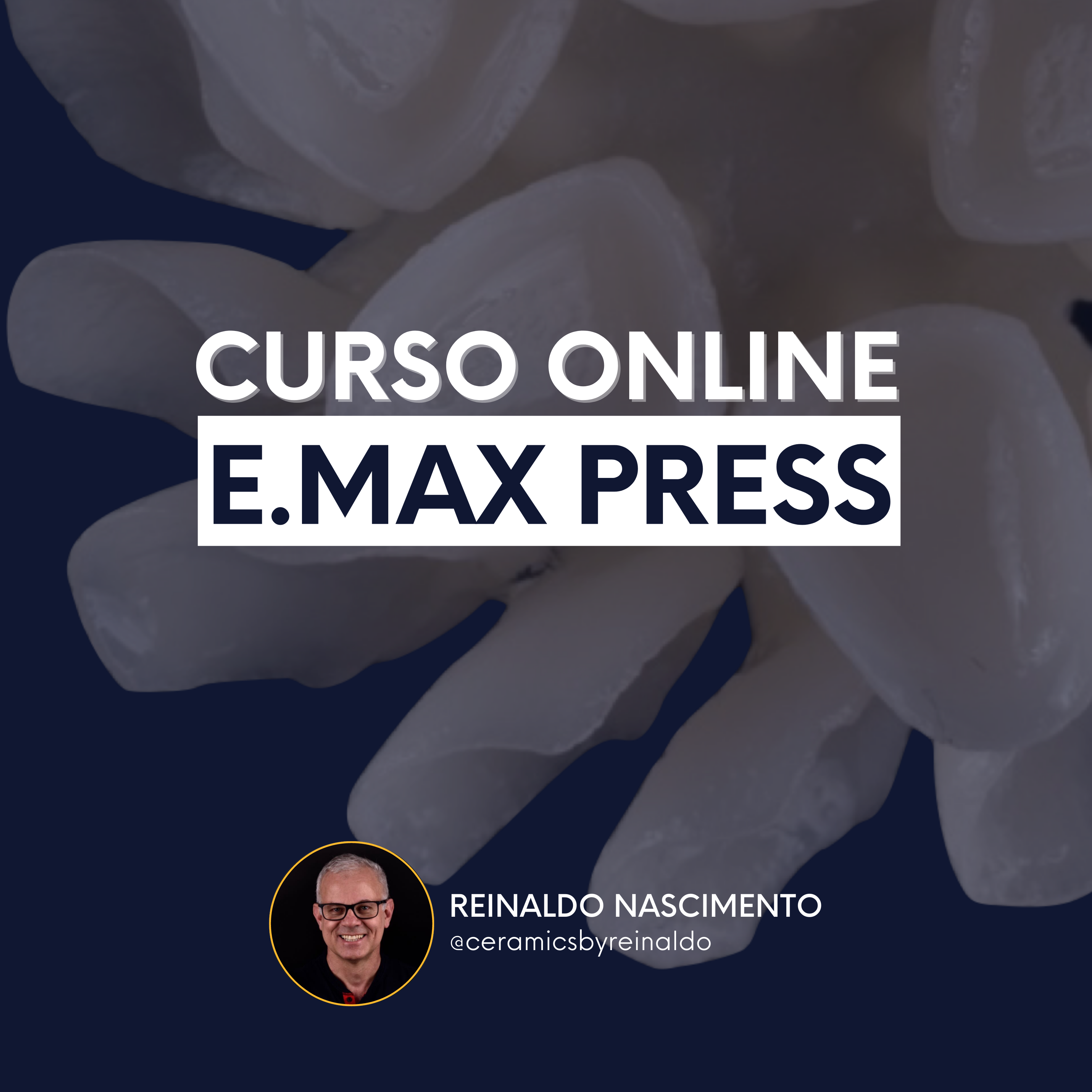 E.max Press com TPD Reinaldo Nascimento - LH Odontologia | Hotmart