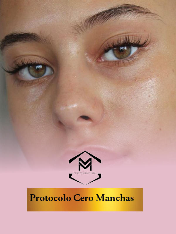 Protocolo Cero Manchas - Marcas Millonarias | Hotmart