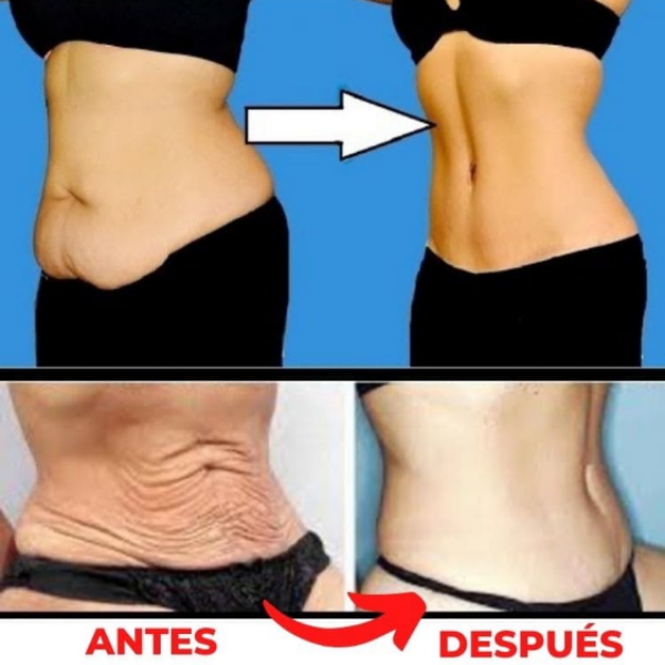 Zero Flacidez y celulitis