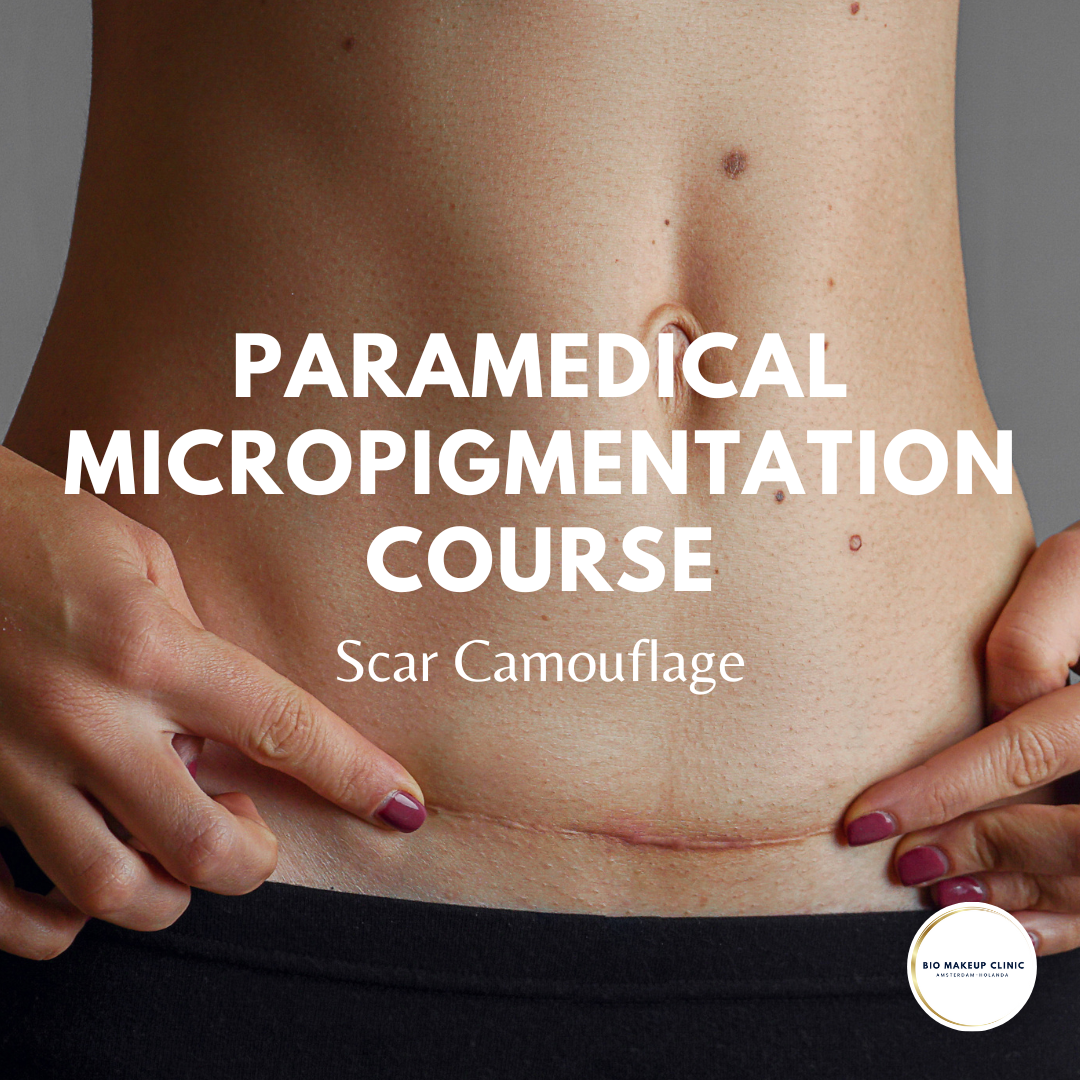 Paramedical Micropigmentation Course - Scar Camouflage
