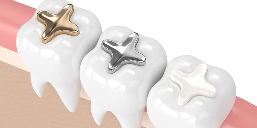 guide to obturate (odontology)
