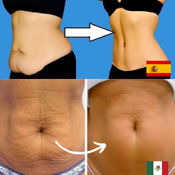 ZERO FLACIDEZ Y CELULITIS - 2024 - David Perez | Hotmart