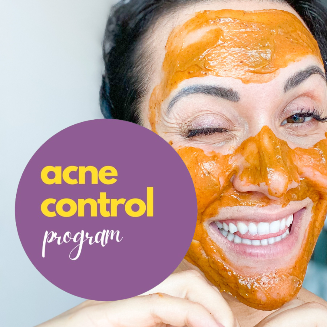 Acne Control Program - Método Natural e Seguro para Mulheres Adulta...
