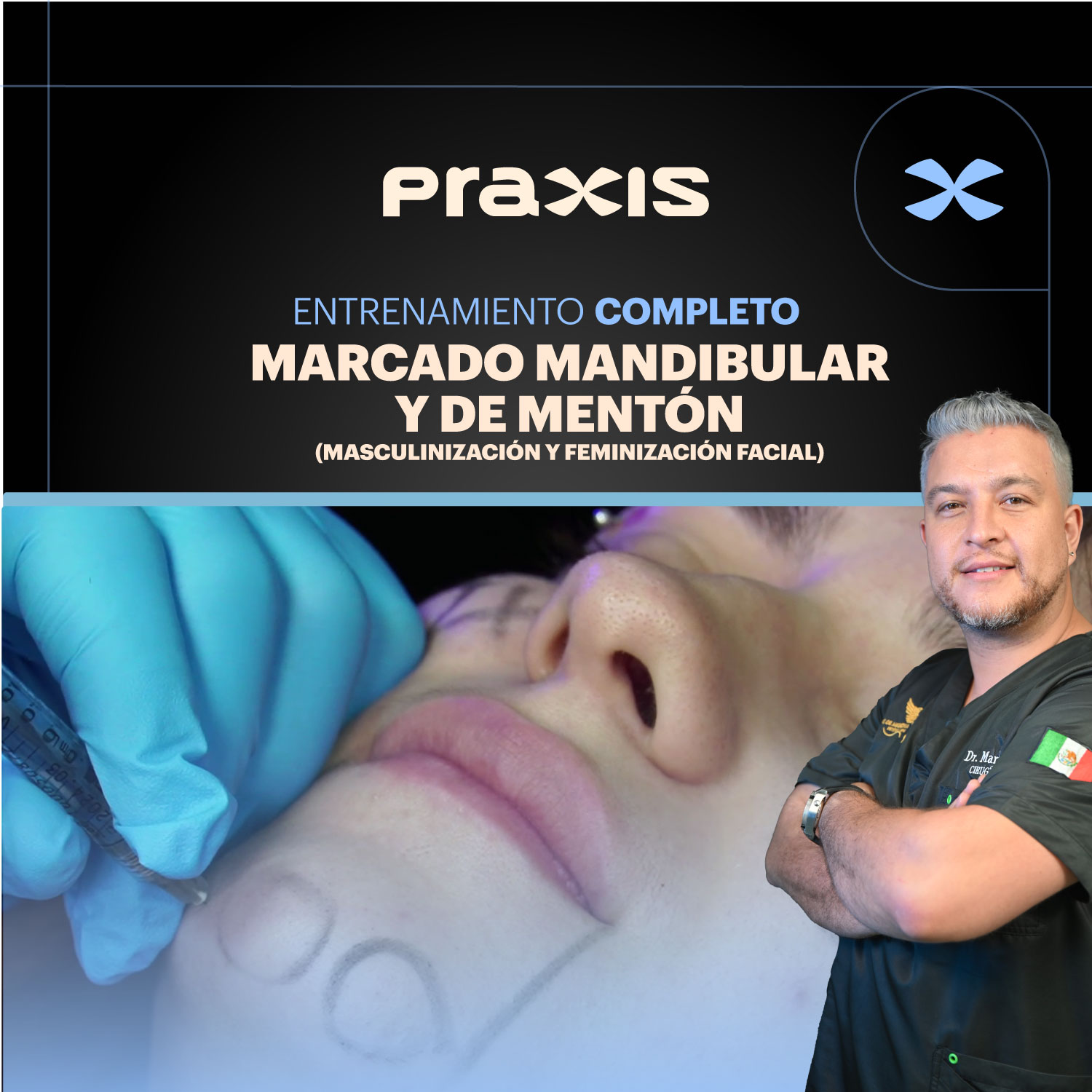 Marcado mandibular y de mentón (masculinización y feminización faci...