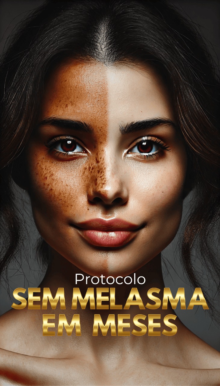 Protocolo 100 Melasma - Avulso - Janaína Laurentino | Hotmart