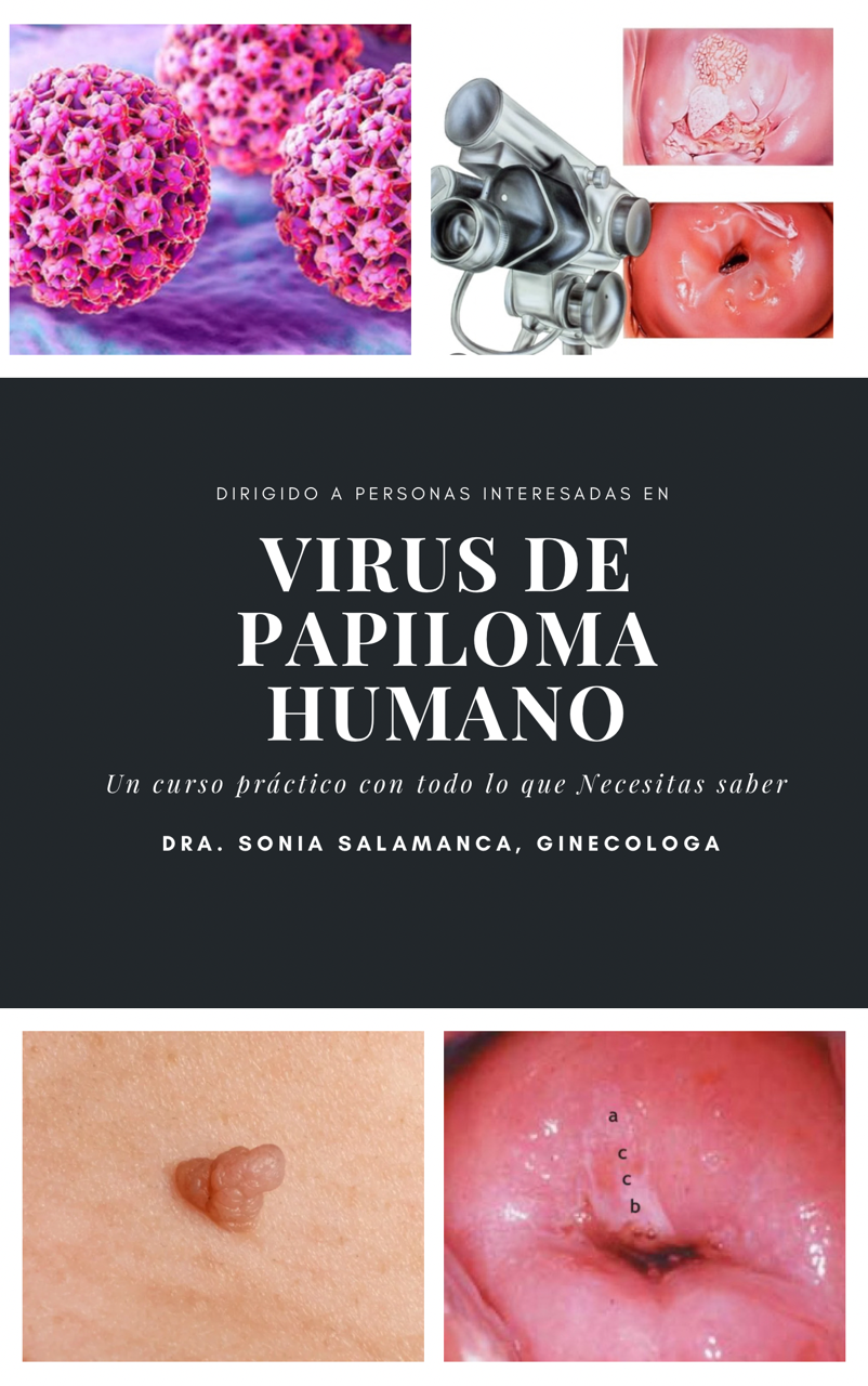 Entendiendo el Virus de papiloma Humano - Sonia Salamanca Mora | Ho...