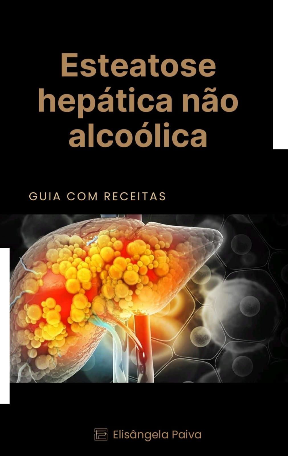 Esteatose hepática não alcoólica - Elisangela do Carmo Antunes de ...
