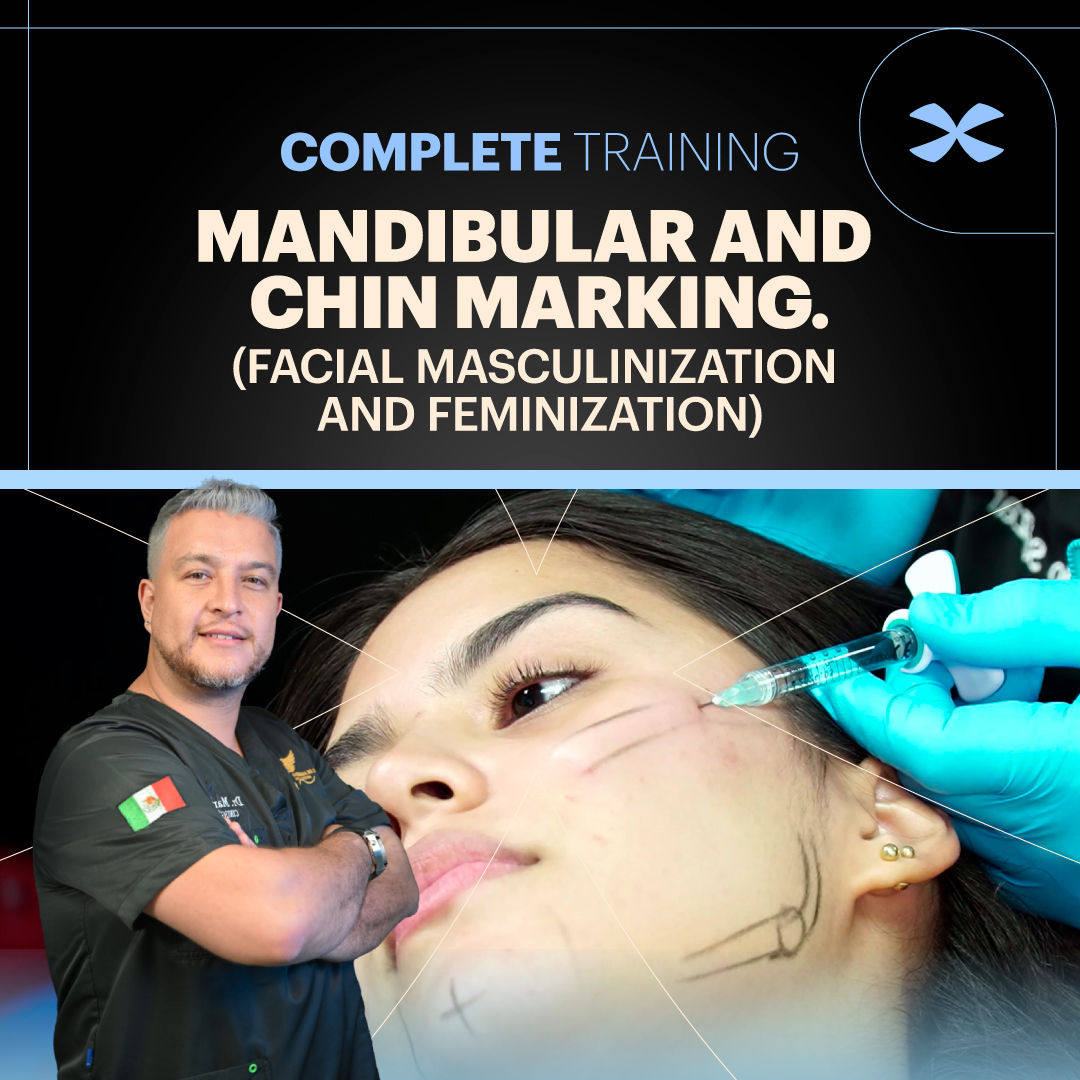 Mandibular and chin marking (facial masculinization and feminization)
