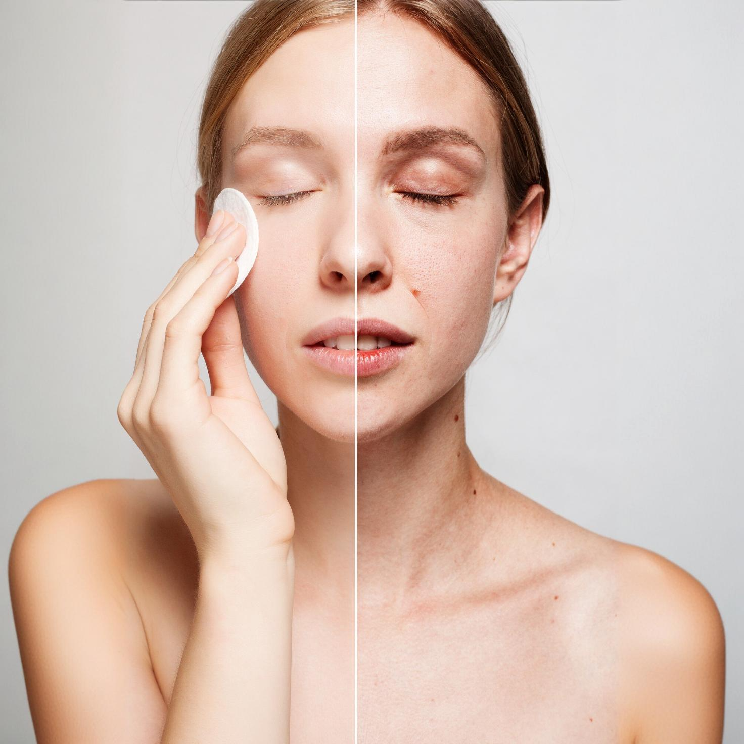 Protocolo Piel Renovada | Recetas ocultas para la piel del bebé - D...