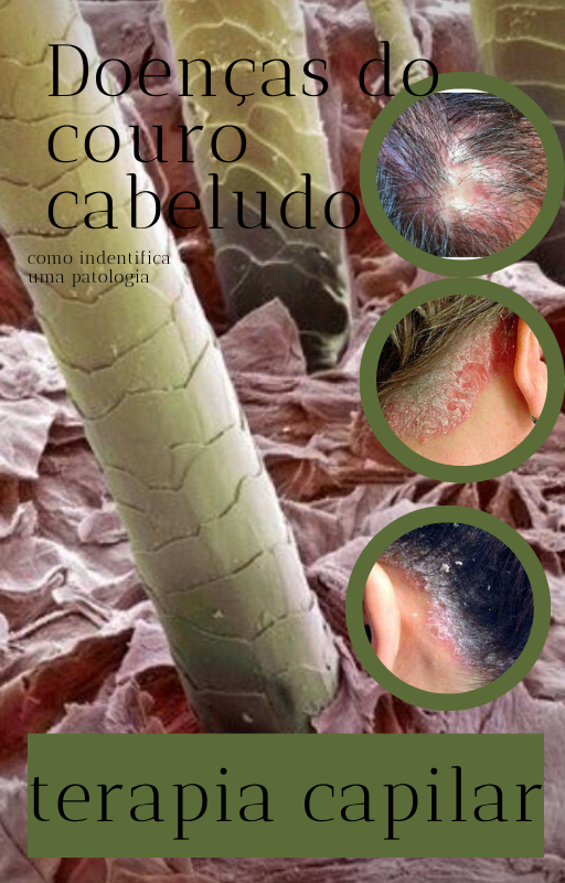 Terapia capilar doenças do couro cabeludo - Karen Silva | Hotmart
