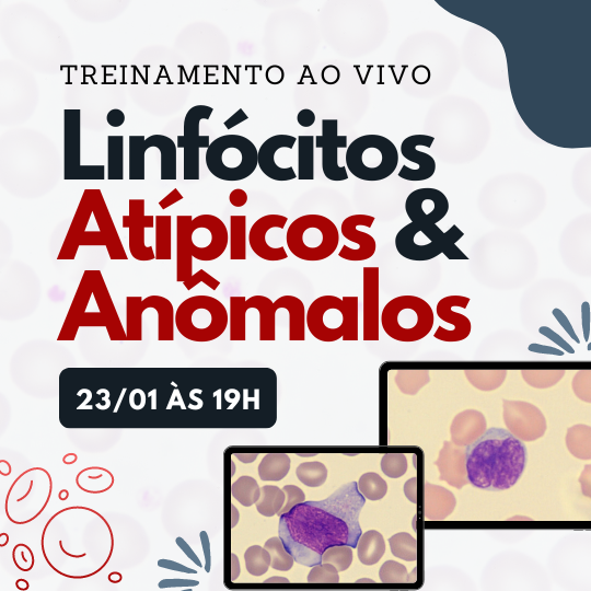Treinamento de Linfócitos Atípicos e Anômalos - Luiz Arthur Calheir...