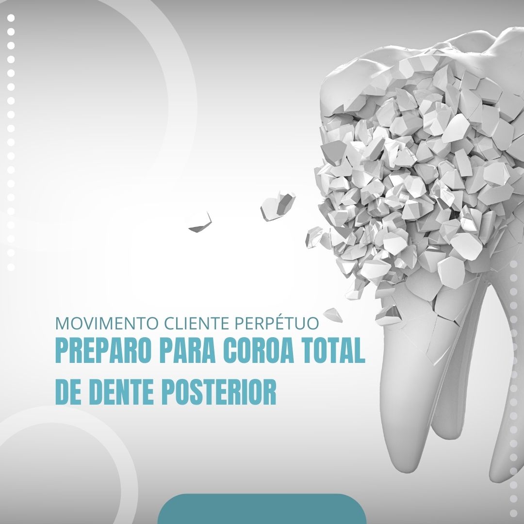 MOVIMENTO CP - Preparo para coroa total de dente posterior. - INSTI...