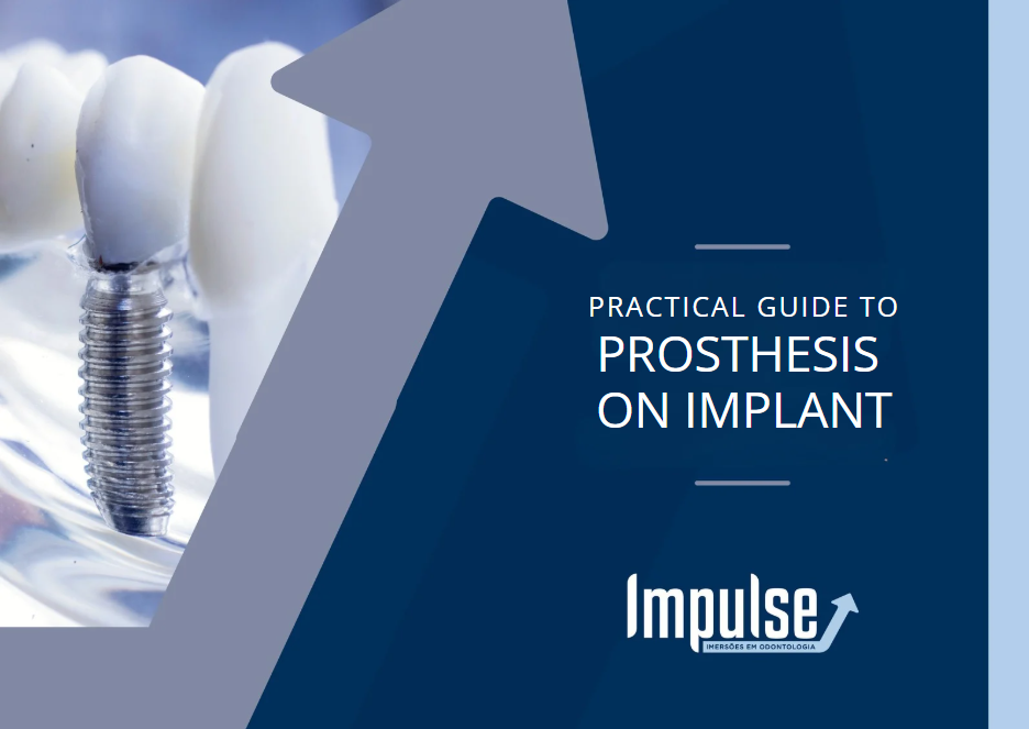 Guide To Prosthesis on Implant + PDF Manual - Pedro Cantarelli Nery...