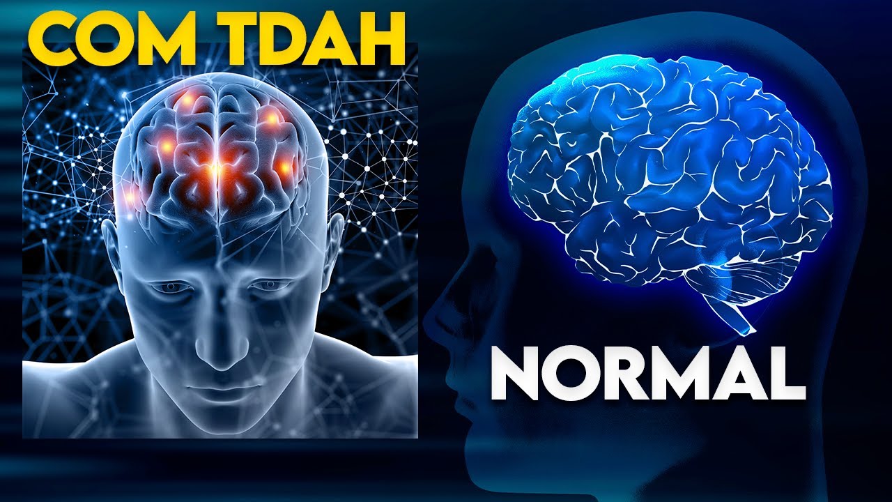 Compreendendo e Enfrentando o TDAH: Um Guia Completo - Anderson As...