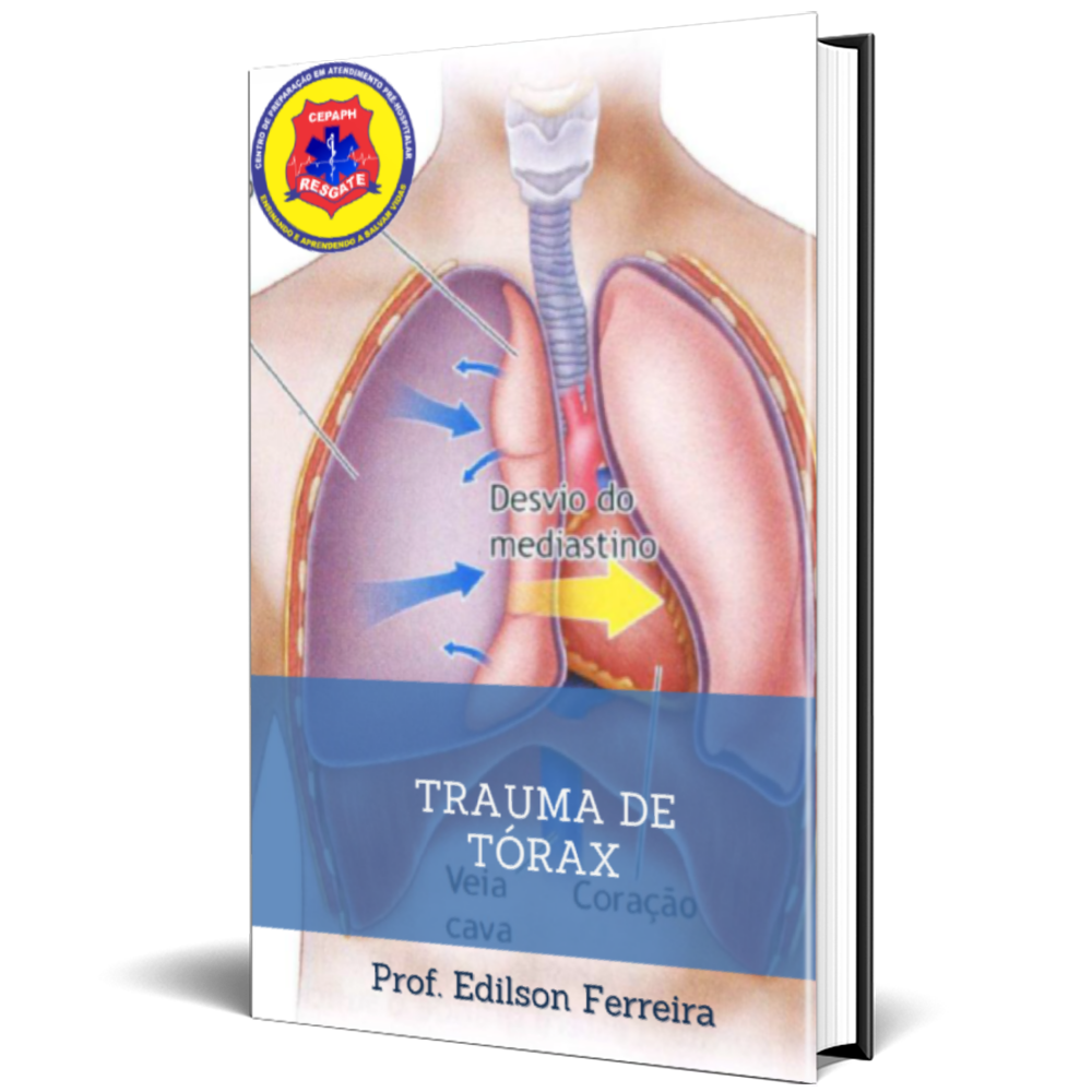 TRAUMA DE TÓRAX — GUIA ESSENCIAL PARA PROFISSIONAIS DE SAÚDE E PÚBL...