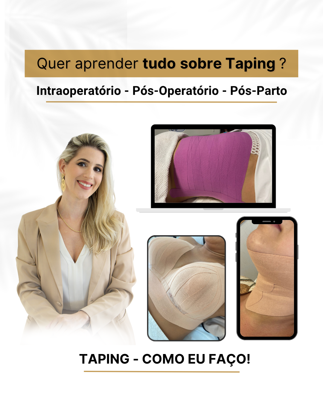 Taping - Pós-Operatório e Pós-Parto - Gisele Godoy Cordeiro | Hotmart