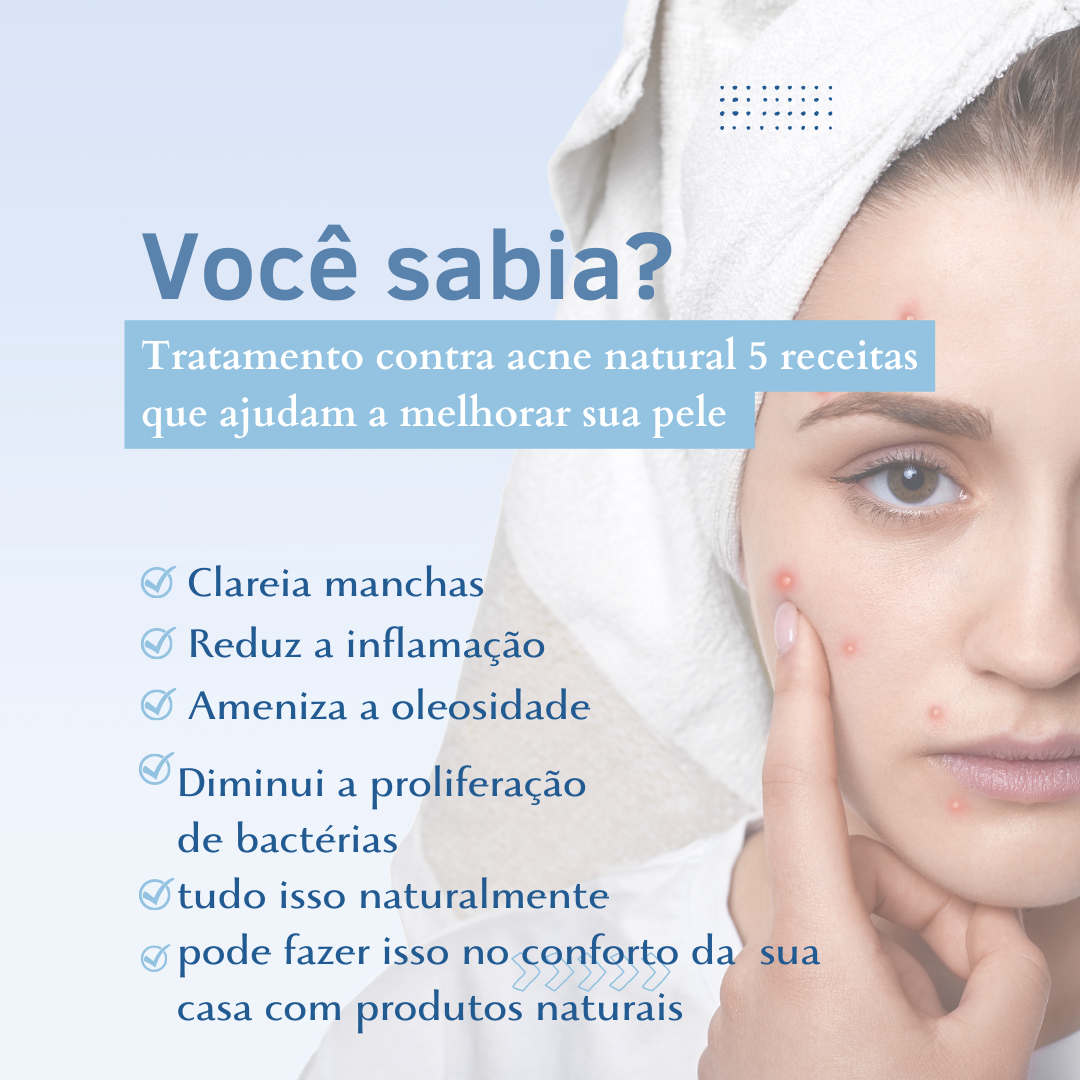 5 RECEITAS NATURAIS QUE AJUDAM COMBATER Á ACNE