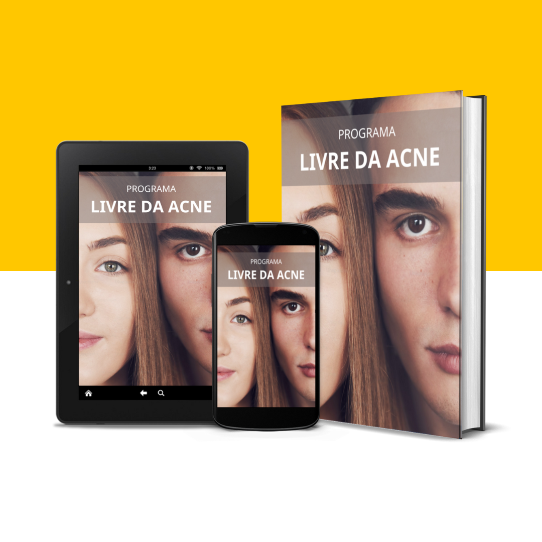 Programa Livre da Acne
